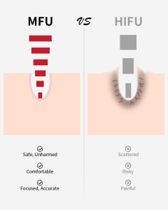 Hifu Machine - MFUpro®