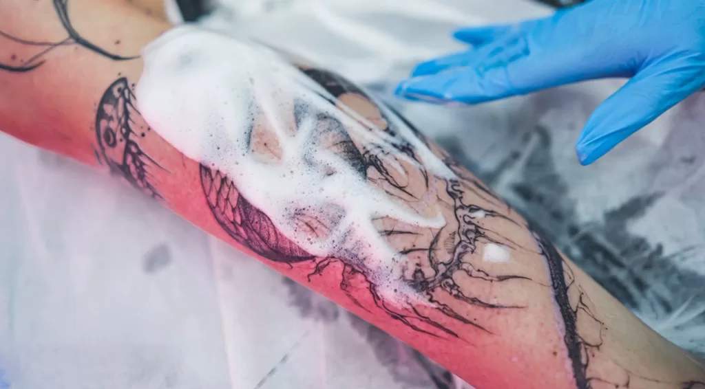 Multi-Color Tattoo Removal Laser: Guide for Clinics & Aesthetic - PZLASER